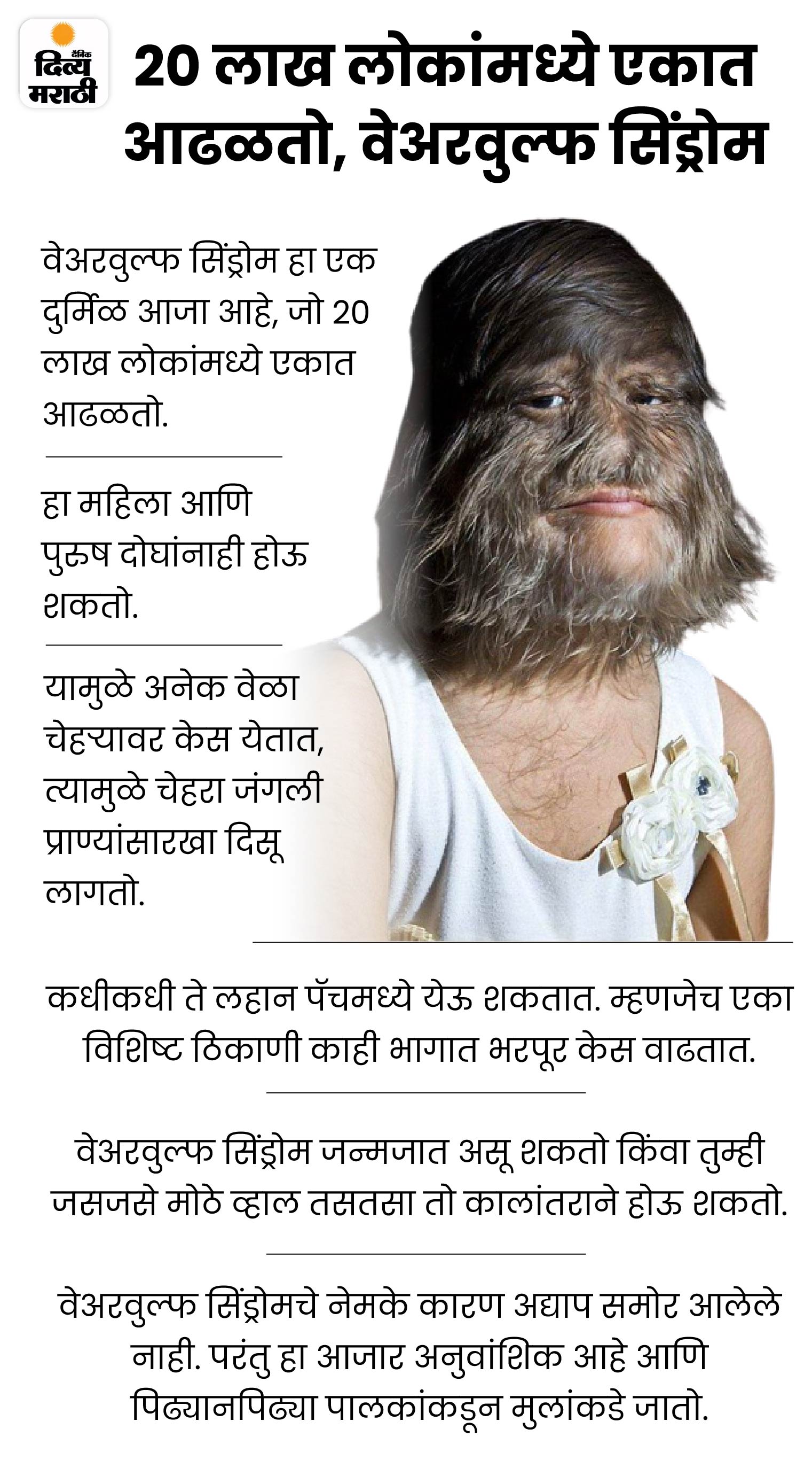 A disease called werewolf syndrome in Lalit, fear of getting the ...