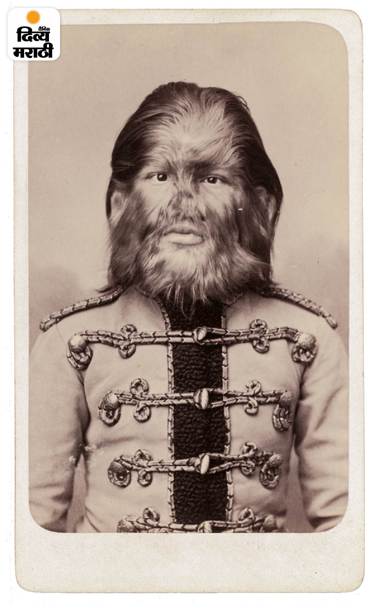 A disease called werewolf syndrome in Lalit, fear of getting the ...