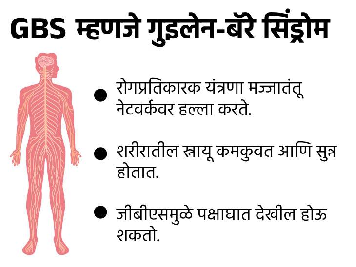 Gbs Cases Updates Maharashtra Pune Guillain Barre Syndrome Deaths Rises ...