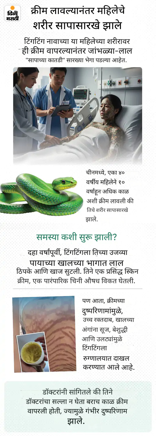 Khabar Hatke Trending Facts; Snake Like Skin Cream | Avisha Tewani Hand ...