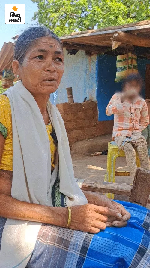 Chhattisgarh Genetic Skin Disorder Case; Tree Man Syndrome Symptoms ...