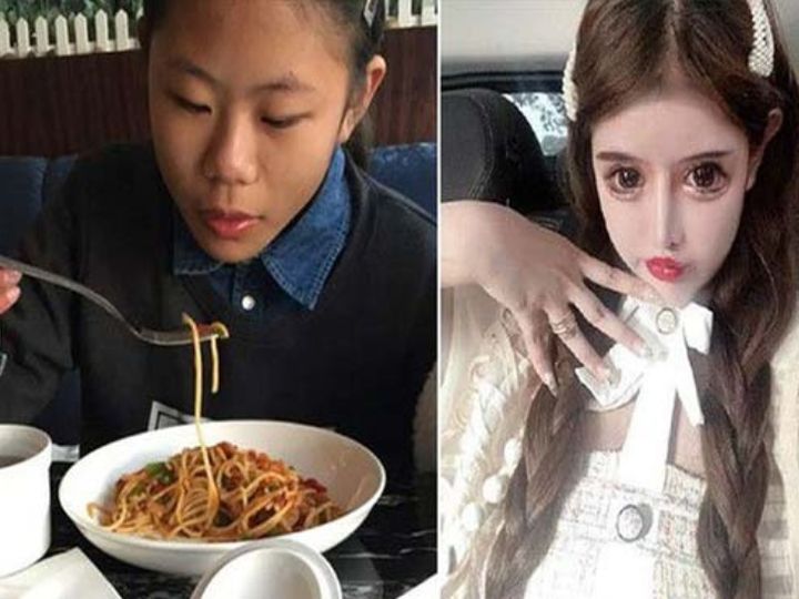 Zhou Chun Of China Has Done 100 Plastic Surgeries At The Age Of 16, In ...