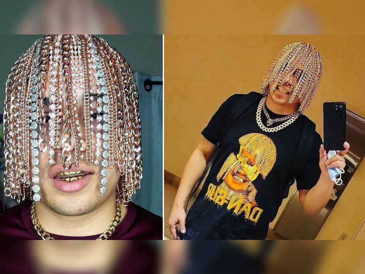 Mexican rapper Dan Sur gets gold chains surgically implanted in his ...