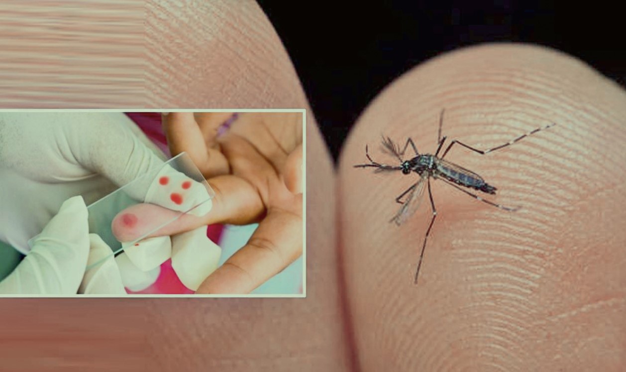 Malaria is very easy to treat if diagnosed early