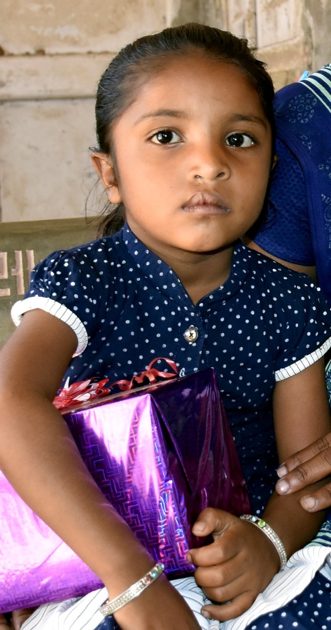 A girl from Kosor village in Sojitra had a hole in her lips and palate ...