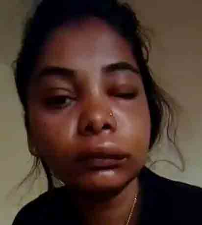 Kannada actress Swati Satish's face disfigured due to wrong surgery ...