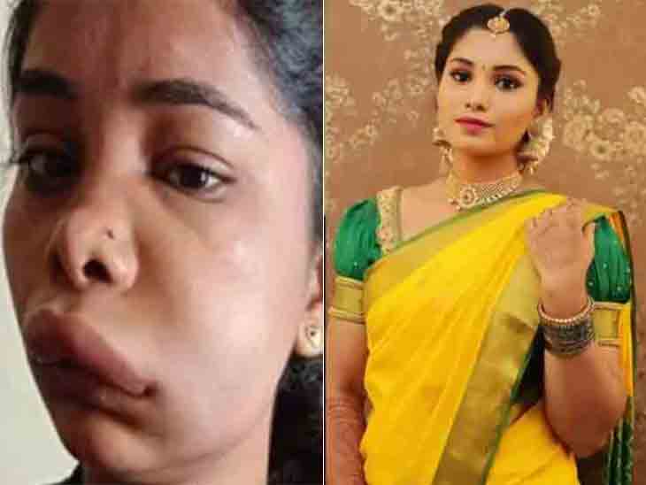 Swati Satish stopped leaving home due to root canal surgery; The job ...