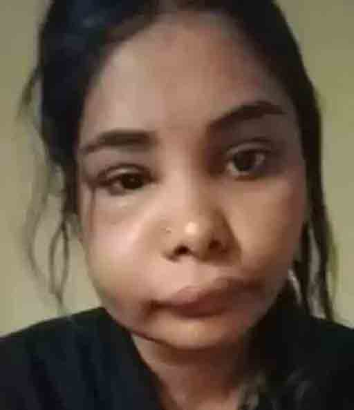 Swati Satish stopped leaving home due to root canal surgery; The job ...