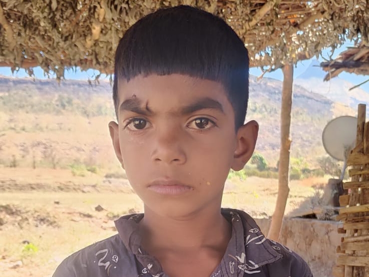An 8-year-old child with an eye disease called ptosis was successfully ...