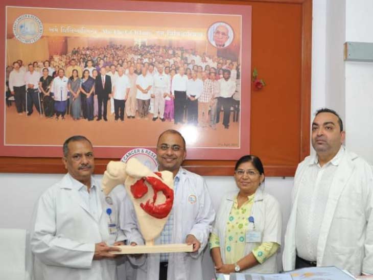 3D printing the largest model of shoulder bone cancer, will provide ...