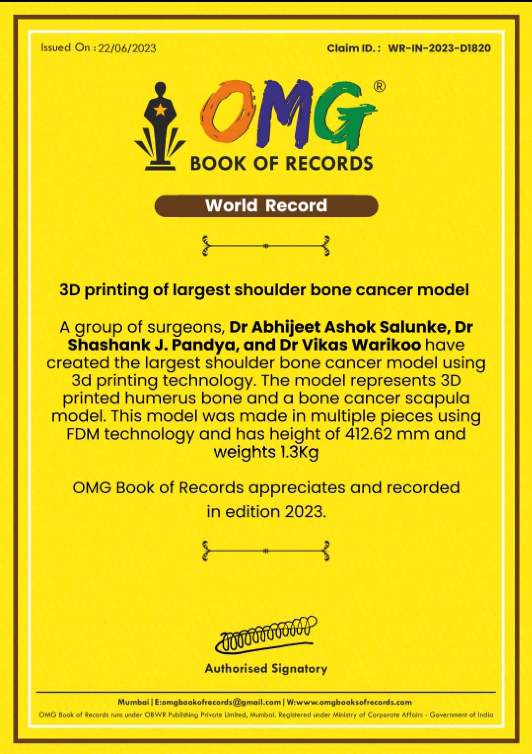 3D printing the largest model of shoulder bone cancer, will provide ...