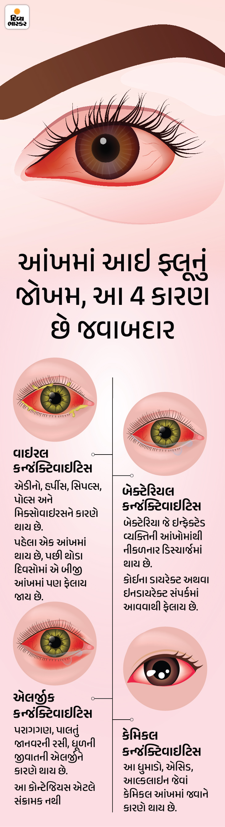 Know the symptoms of eye flu and how to avoid it from an expert | કોઈની ...