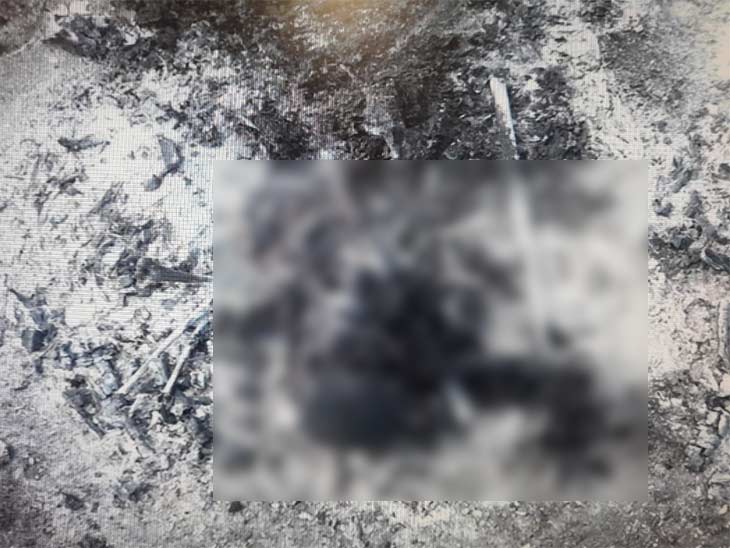 A forensic PM was conducted after a half-burnt body of woman was found ...
