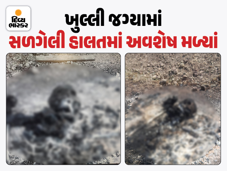 A forensic PM was conducted after a half-burnt body of woman was found ...