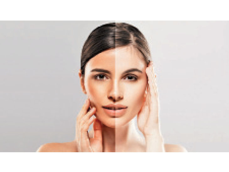 Home Remedies to Remove Tanning