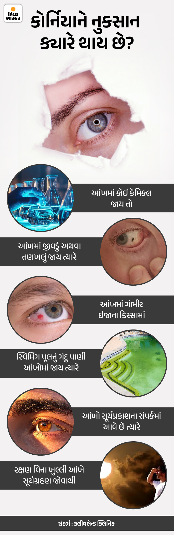 Jasmin Bhasin Eye Injury; Cornea Damage | Contact Lenses Side Effects ...