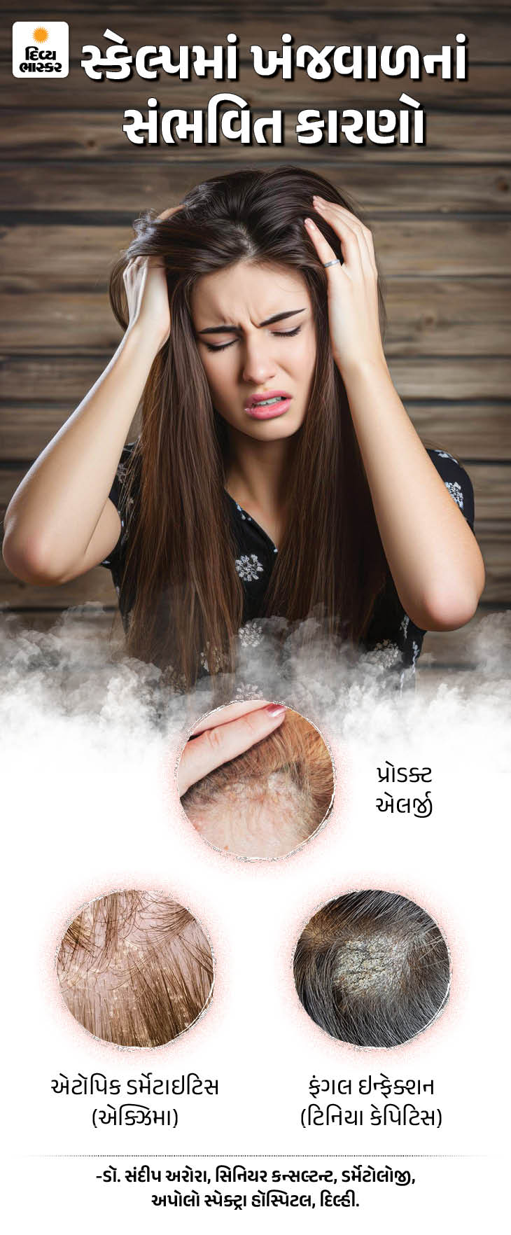 Winter Dandruff Problem: Causes, 10 MISTAKES, 18 Healthy Scalp Hair ...
