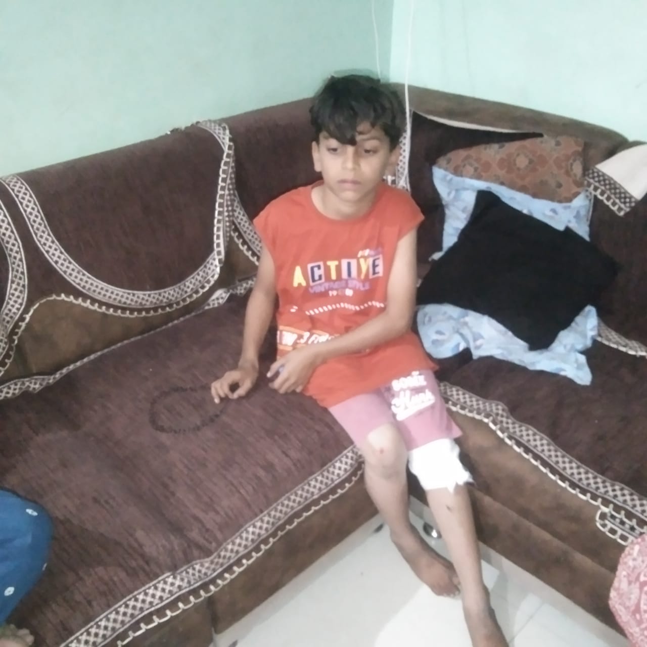 27 people were bitten by dogs in two days in Ankalaw parish | શ્વાનનો આતંક: આંકલાવ પંથકમાં બે ...