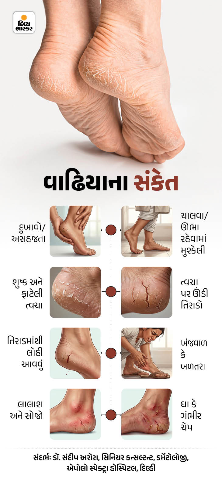 How to Cure Cracked Heels in Winter? Causes, Home Remedies and Expert ...
