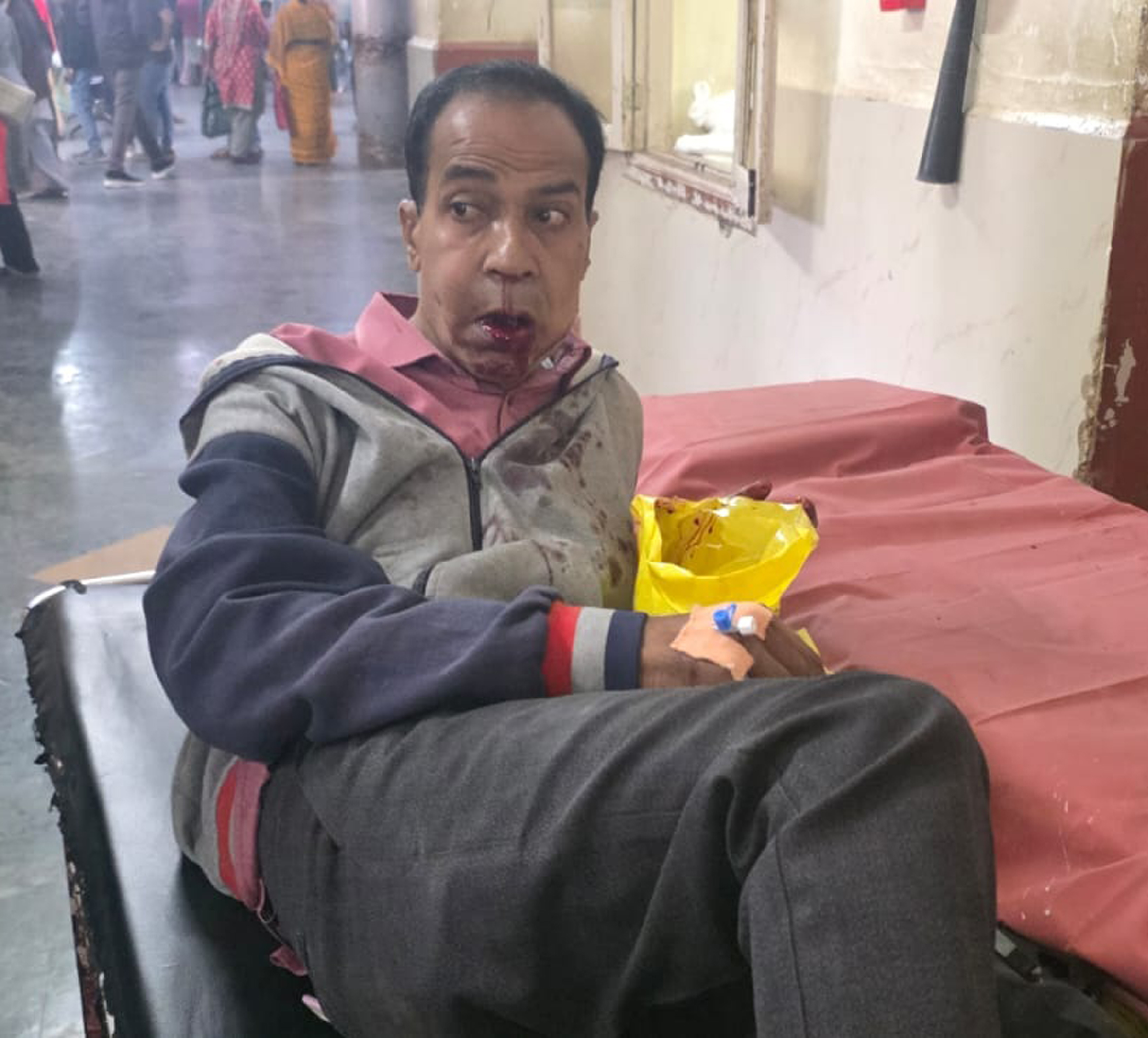 Rider's teeth fell out due to short circuit from running electric bike