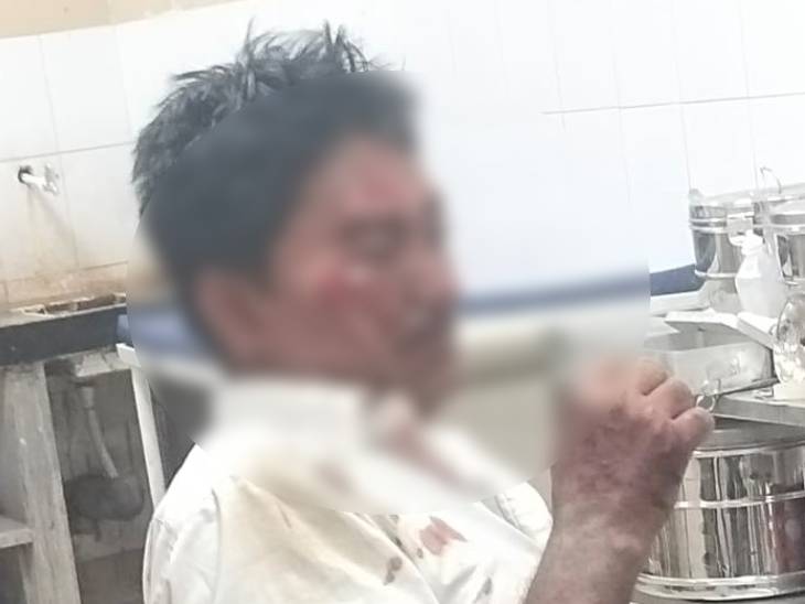 Harij Homeguard Injured in Gutter Accident | Bike Fall